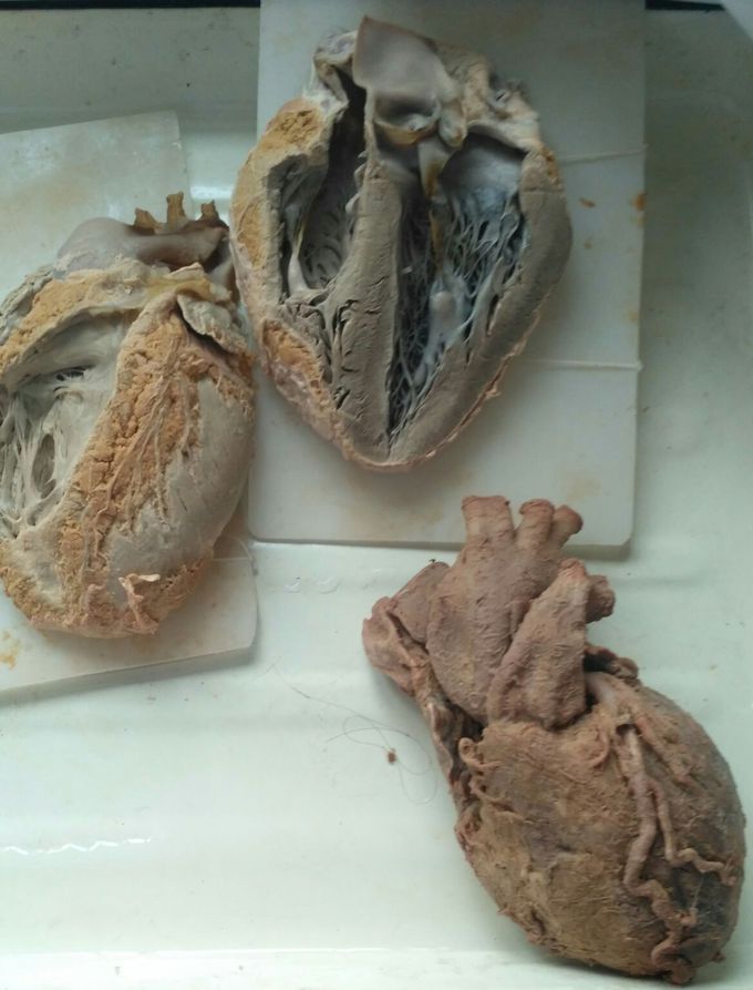Heart Anatomy - MEDizzy