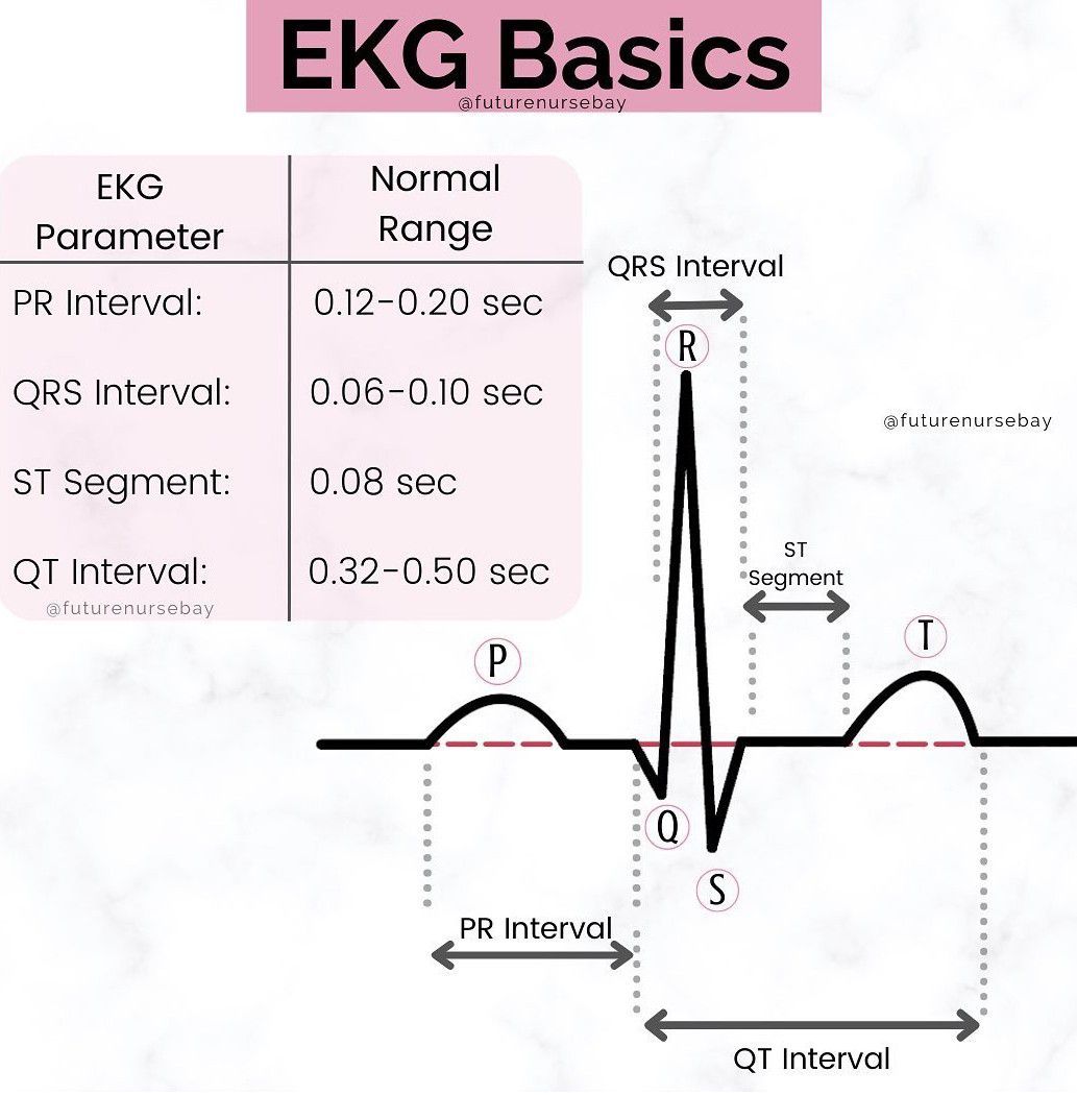 EKG Basics MEDizzy
