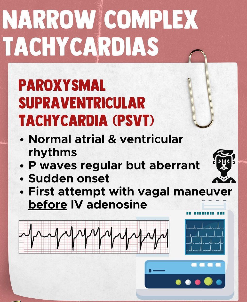 Narrow Complex Tachycardias - MEDizzy