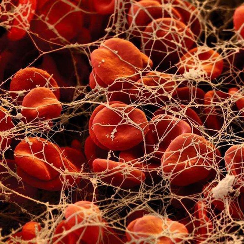 Free Picture Red Blood Cells Enmeshed Fibrinous Matrix SEM Of Red
