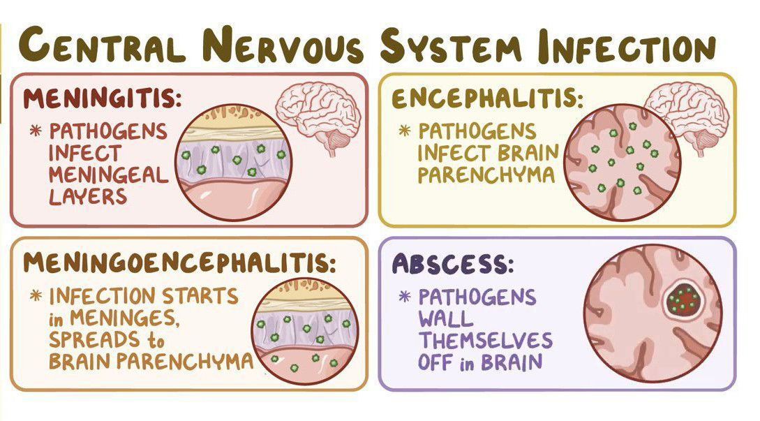 Cause of CNS infection? - MEDizzy