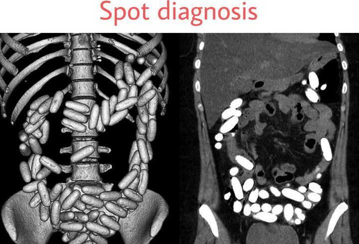 Spot Diagnosis - MEDizzy