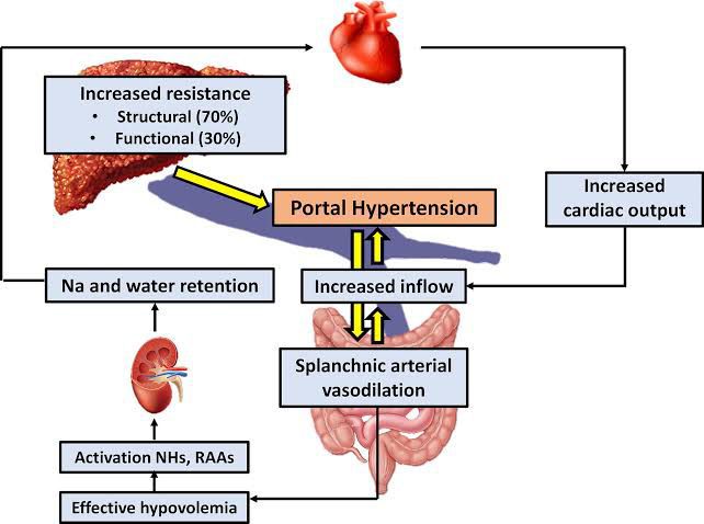 Portal hypertension - MEDizzy