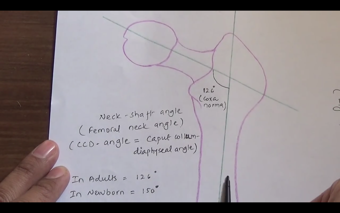Neck of femar - MEDizzy